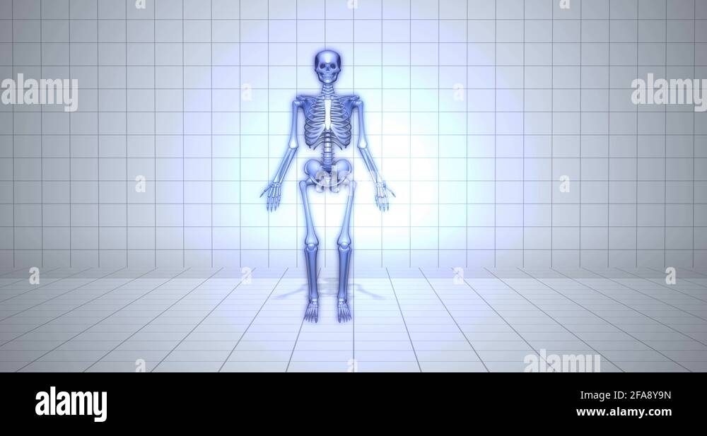 Human Forensic Autopsy Animation Concept - Cause of Death - Accidental ...