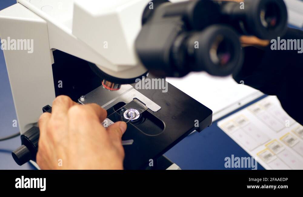 Biopsy slide Stock Videos & Footage - HD and 4K Video Clips - Alamy