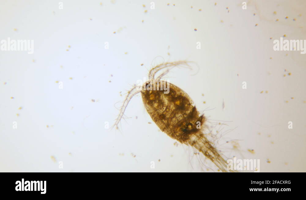 Male cyclops under the microscope in lake water. Close up. UHD 4K Stock ...
