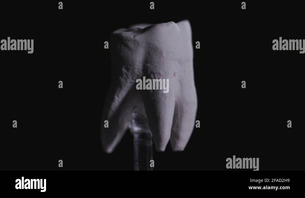 Human wisdom tooth Stock Videos & Footage - HD and 4K Video Clips - Alamy