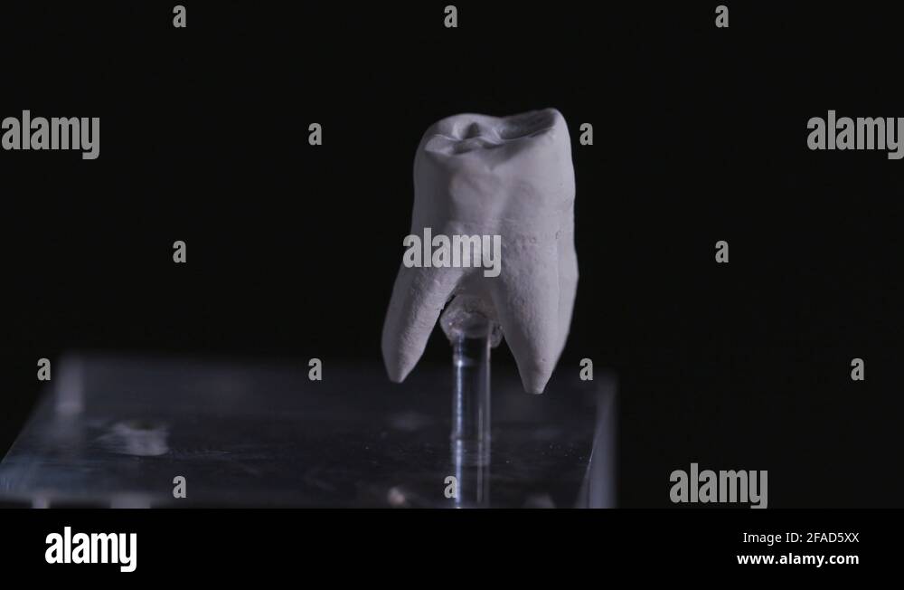 Different tooth shapes Stock Videos & Footage - HD and 4K Video Clips ...