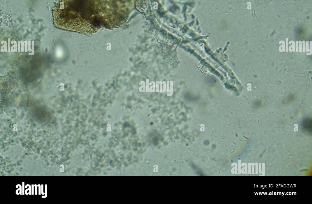 Microscopic view water Stock Videos & Footage - HD and 4K Video Clips ...