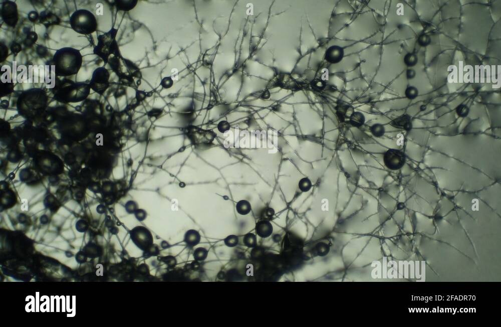 Mold spore hyphae Stock Videos & Footage - HD and 4K Video Clips - Alamy