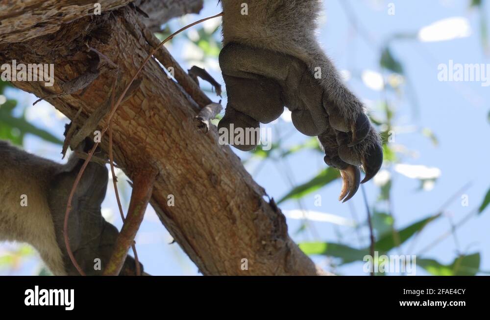 Limp hand Stock Videos & Footage - HD and 4K Video Clips - Alamy