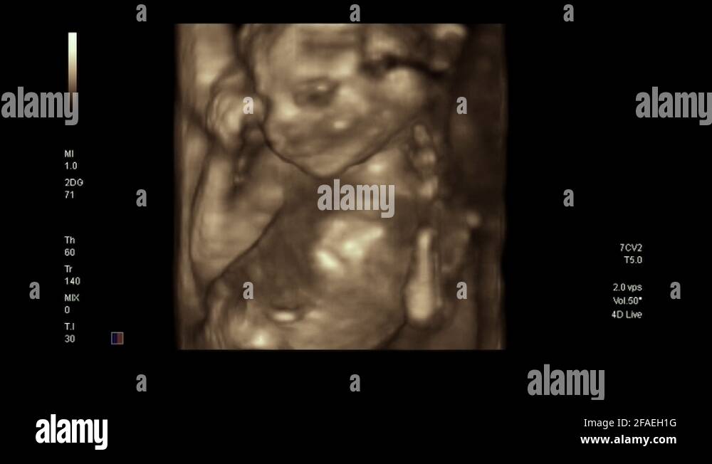Fetal echography Stock Videos & Footage - HD and 4K Video Clips - Alamy