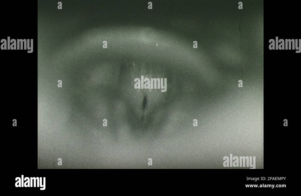 Larynx normal Stock Videos & Footage - HD and 4K Video Clips - Alamy