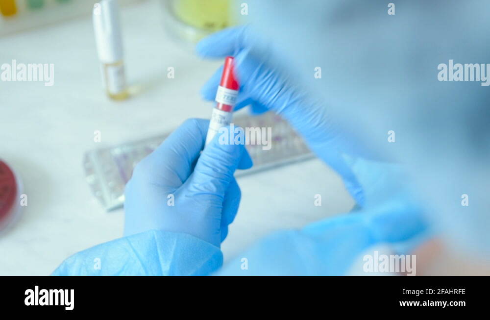 Reagent dispenser Stock Videos & Footage - HD and 4K Video Clips - Alamy