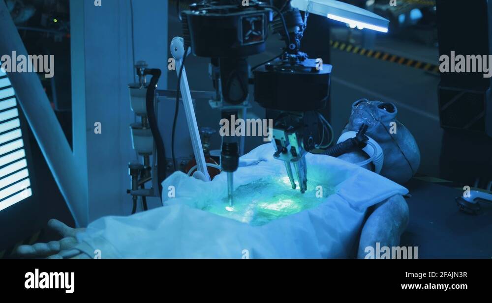 Humanoid surgery is performed, opening the abdomen. Alien in the ...