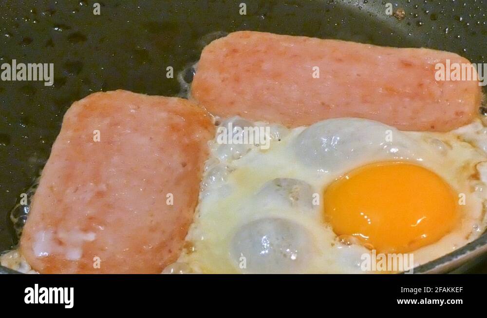 Heart attack high cholesterol Stock Videos & Footage - HD and 4K Video ...