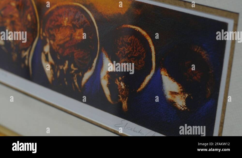 Cat brain anatomy Stock Videos & Footage - HD and 4K Video Clips - Alamy