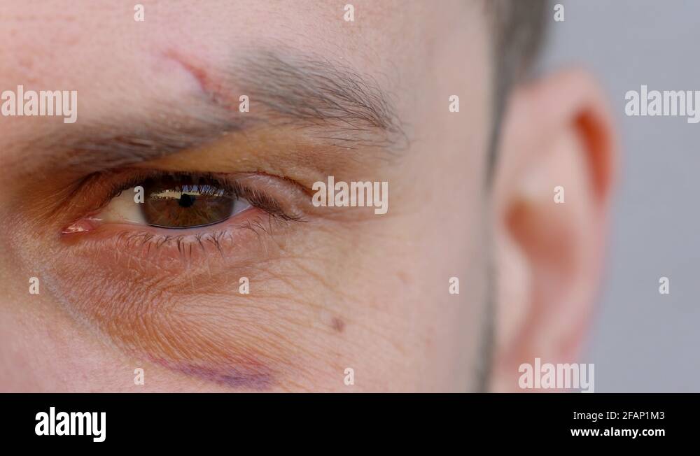 Dissection eyebrow Stock Videos & Footage - HD and 4K Video Clips - Alamy