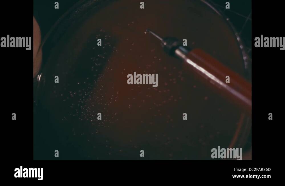 Blood sample under microscope Stock Videos & Footage - HD and 4K Video ...