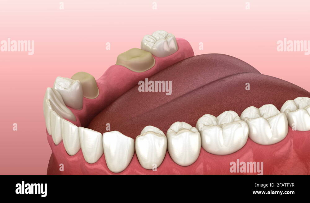 3 teeth Stock Videos & Footage - HD and 4K Video Clips - Alamy