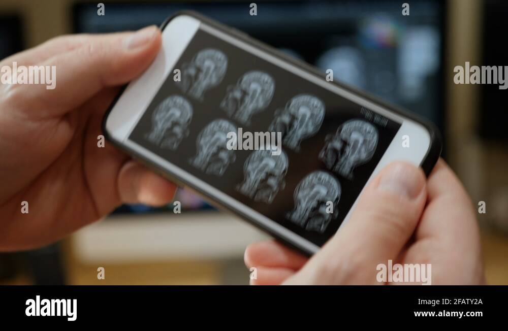 Brain scan mri Stock Videos & Footage - HD and 4K Video Clips - Alamy