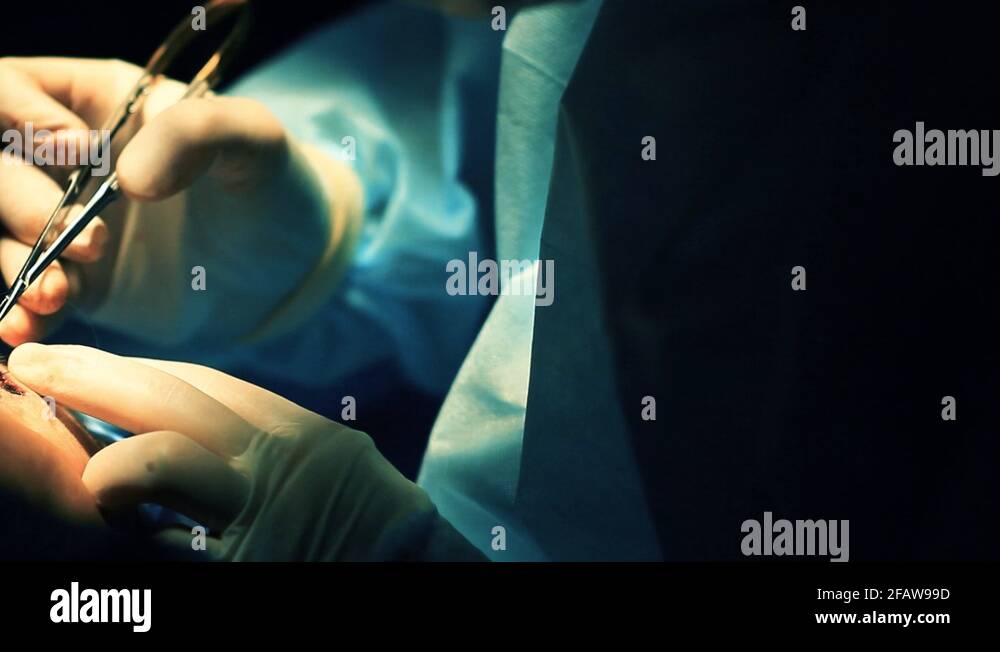 Stitches after surgery Stock Videos & Footage - HD and 4K Video Clips ...