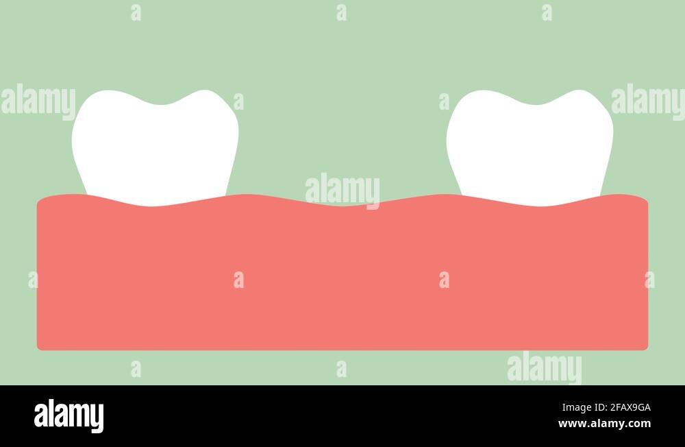 Space of tooth Stock Videos & Footage - HD and 4K Video Clips - Alamy