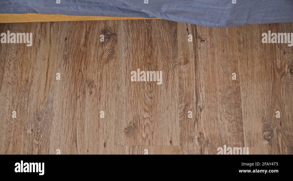 Men leg after a sprained ligament injury close up2 Stock Video Footage ...