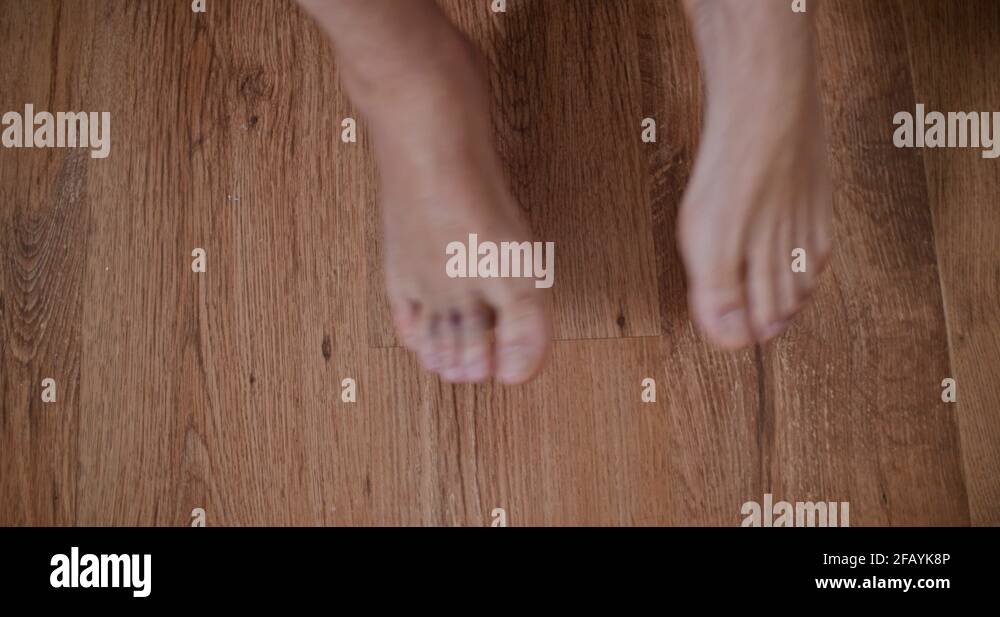 Men leg after a sprained ligament injury close up Stock Video Footage ...