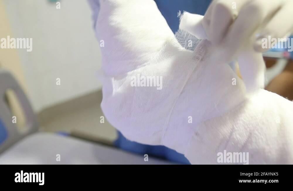 Bone fracture Stock Videos & Footage - HD and 4K Video Clips - Alamy