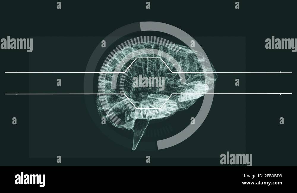 Montage cerebral Stock Videos & Footage - HD and 4K Video Clips - Alamy