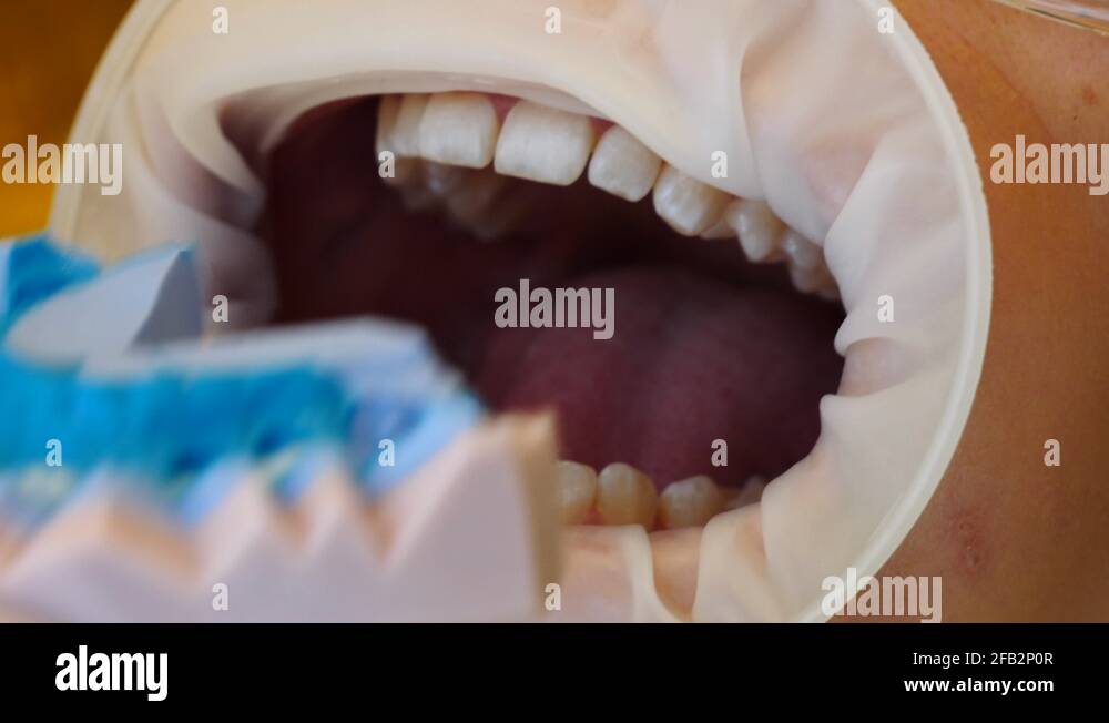 Teeth mold Stock Videos & Footage - HD and 4K Video Clips - Alamy
