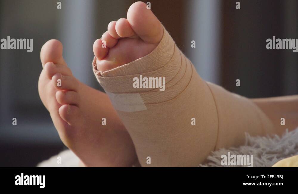 Right ankle fracture Stock Videos & Footage - HD and 4K Video Clips - Alamy