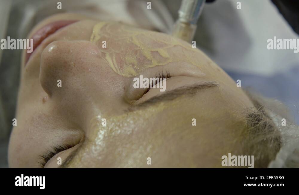 Micro needling Stock Videos & Footage - HD and 4K Video Clips - Alamy