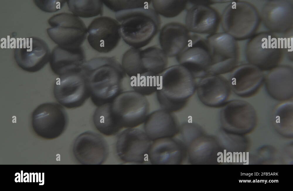 Eggs of brine shrimp under microscope. The microscopic world. Artemia ...