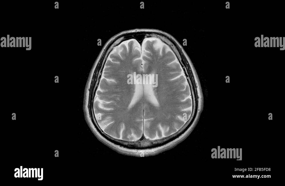 Slice mri scan Stock Videos & Footage - HD and 4K Video Clips - Alamy