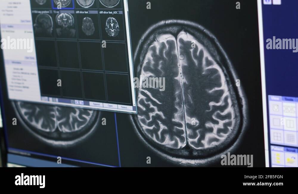 Brain scan computer Stock Videos & Footage - HD and 4K Video Clips - Alamy