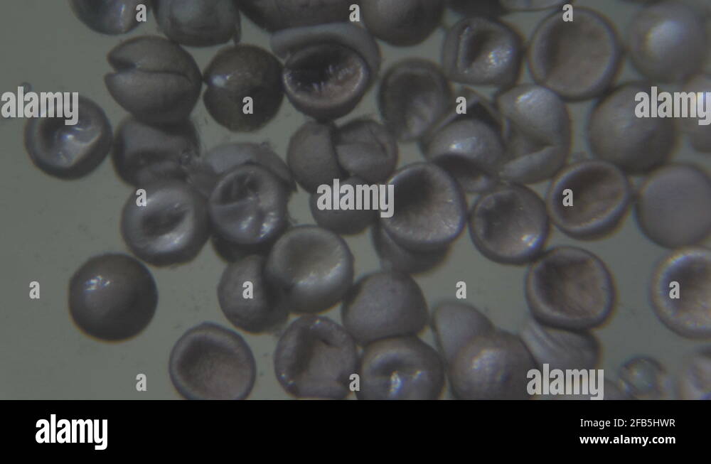 Eggs of brine shrimp under microscope. The microscopic world. Artemia ...