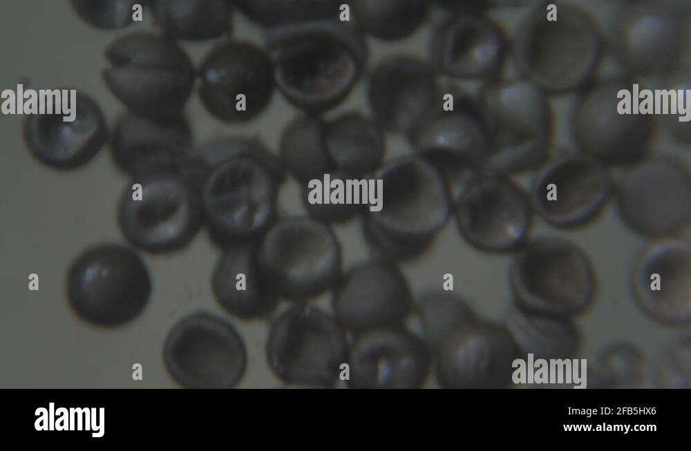 Eggs of brine shrimp under microscope. The microscopic world. Artemia ...