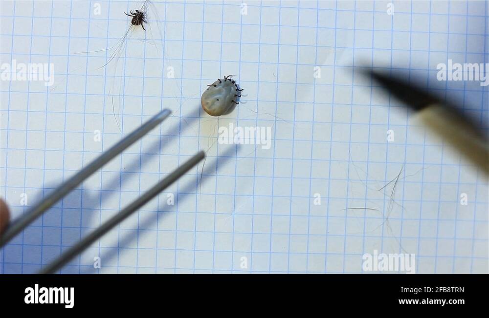 Dissection tool Stock Videos & Footage - HD and 4K Video Clips - Alamy