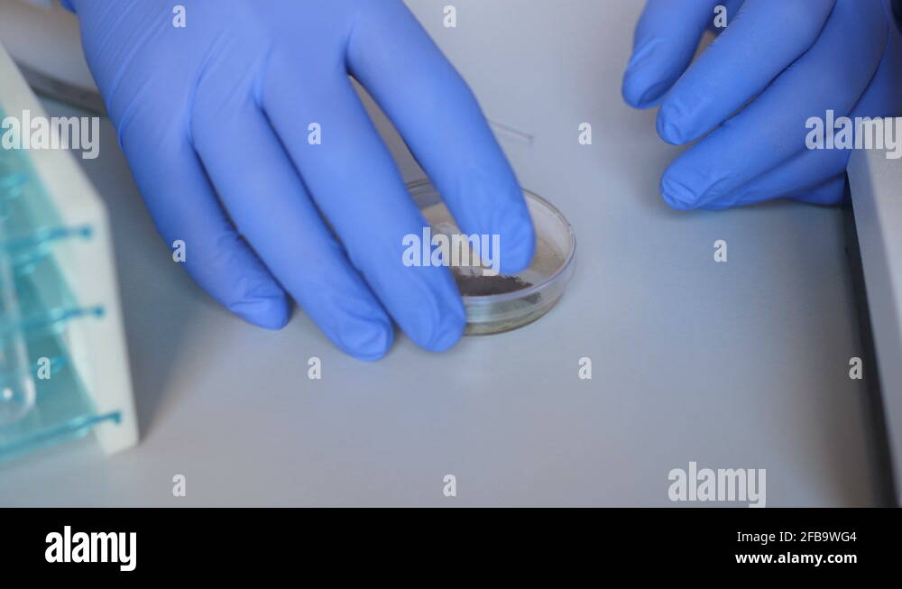 Scientist analyse in bacteria culture. Closeup. Petri dish with ...