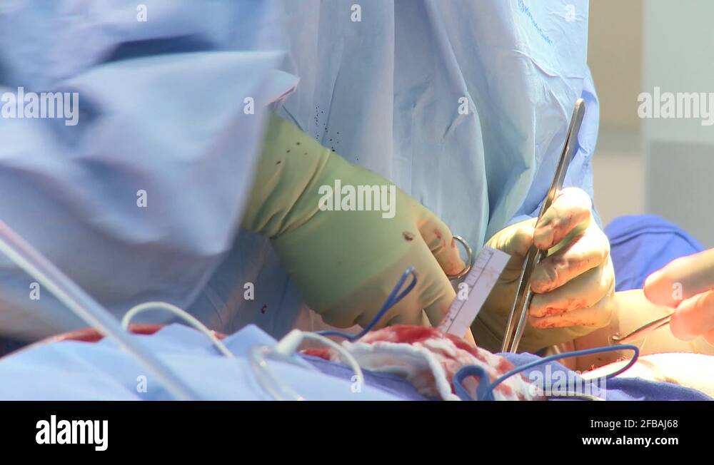 Operating procedures Stock Videos & Footage - HD and 4K Video Clips - Alamy