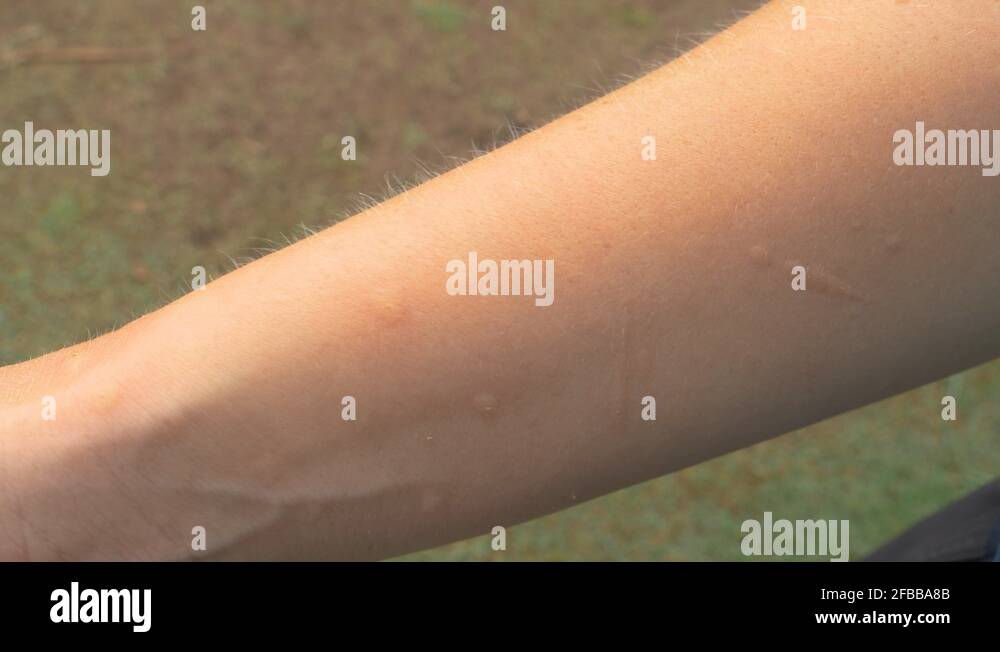 Goose bumps hand Stock Videos & Footage - HD and 4K Video Clips - Alamy