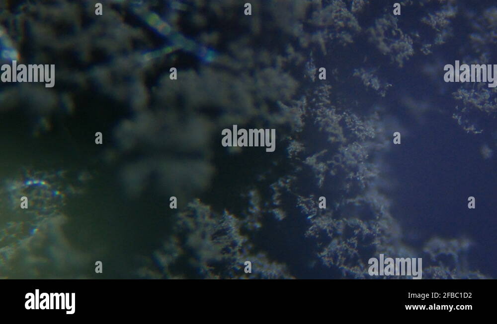 Bread mould microscope Stock Videos & Footage - HD and 4K Video Clips ...