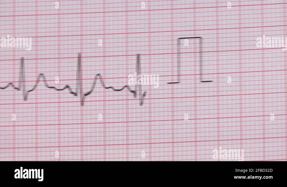 Human electrocardiogram Stock Videos & Footage - HD and 4K Video Clips ...