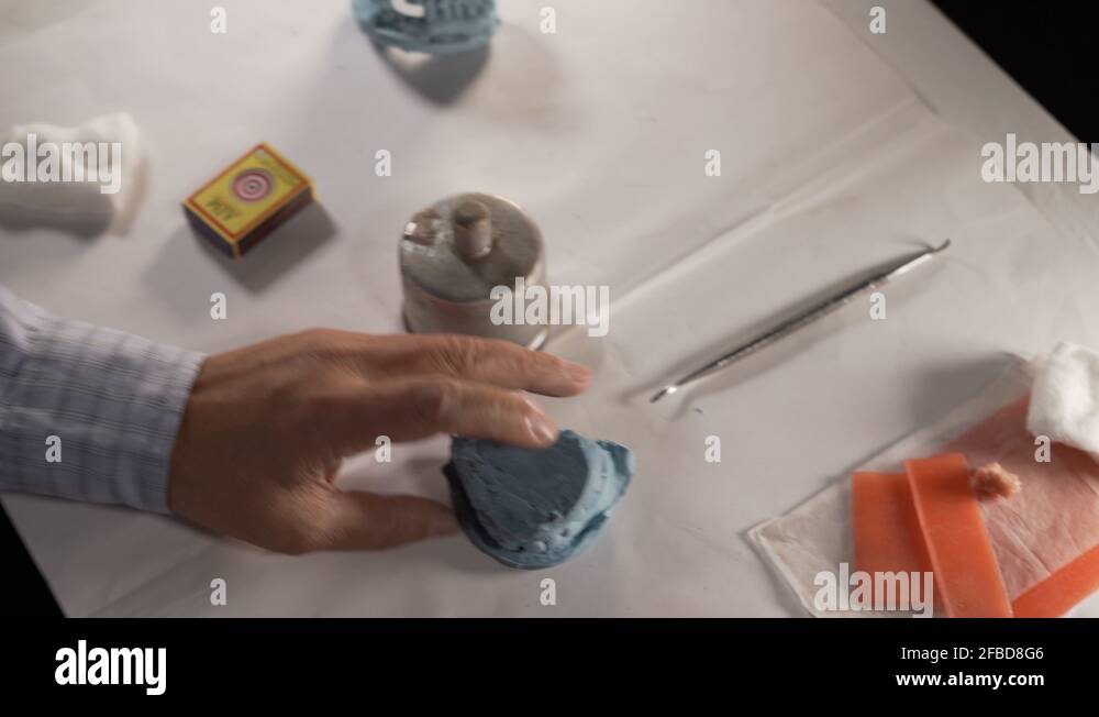 Denture cast Stock Videos & Footage - HD and 4K Video Clips - Alamy