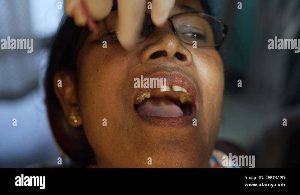 Adjusting jaw Stock Videos & Footage - HD and 4K Video Clips - Alamy