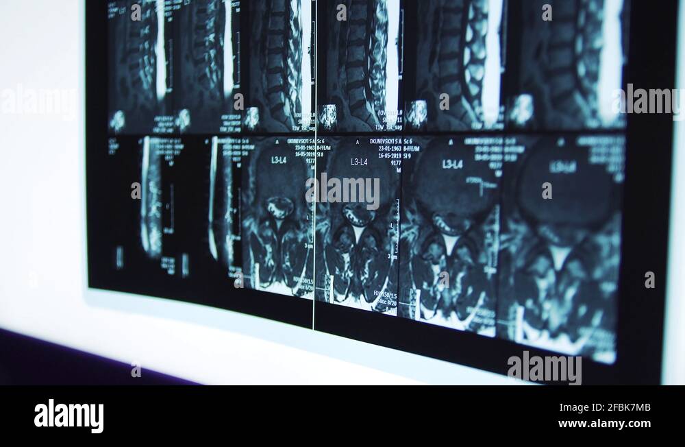 Roentgen radiogram Stock Videos & Footage - HD and 4K Video Clips - Alamy