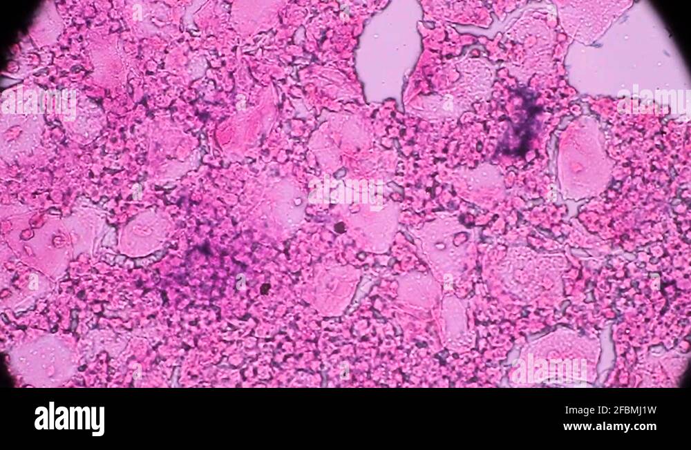 Medical Definition For Sputum Specimen at Susan Burke blog