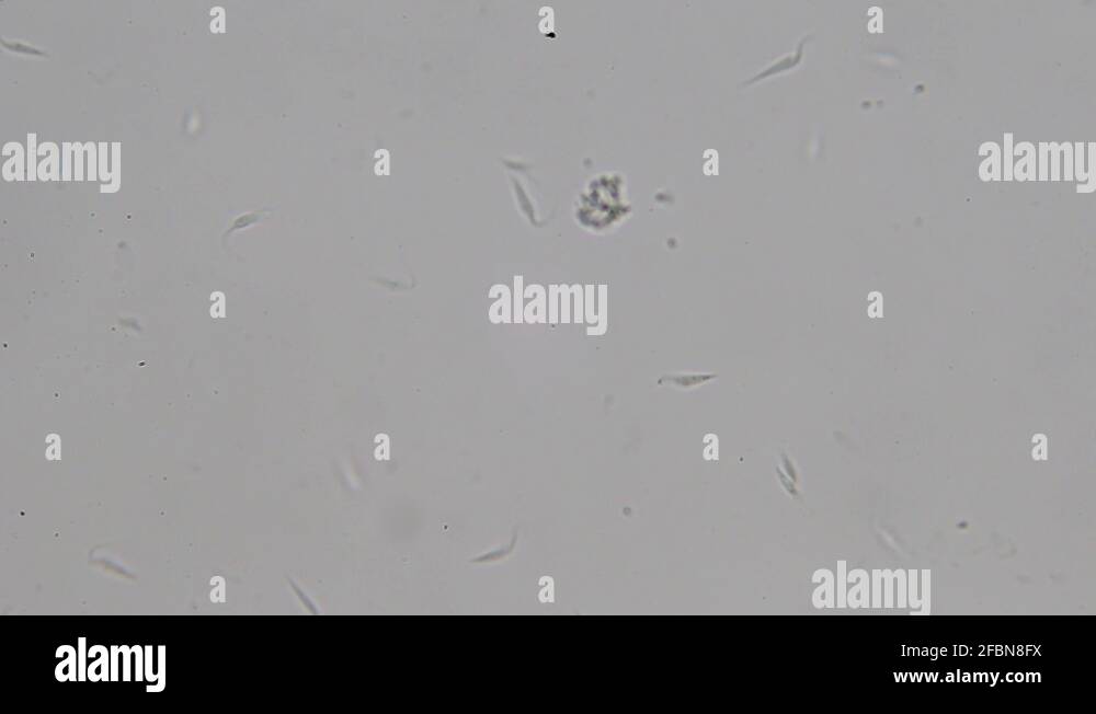 Trypanosoma cruzi microscope view; human diseases Stock Video Footage ...