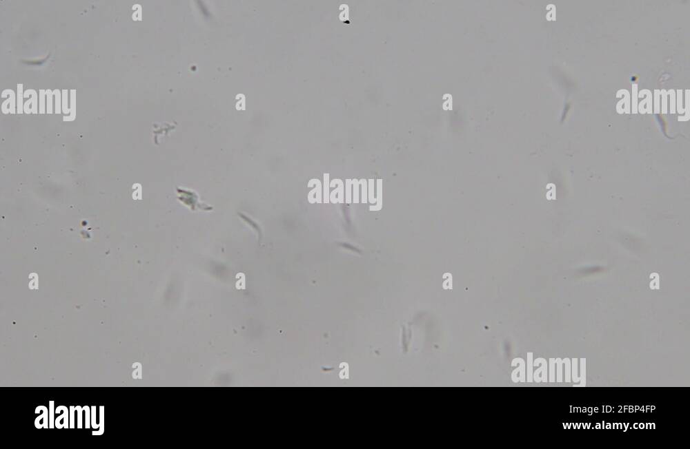 Trypanosoma cruzi microscope view; human diseases Stock Video Footage ...