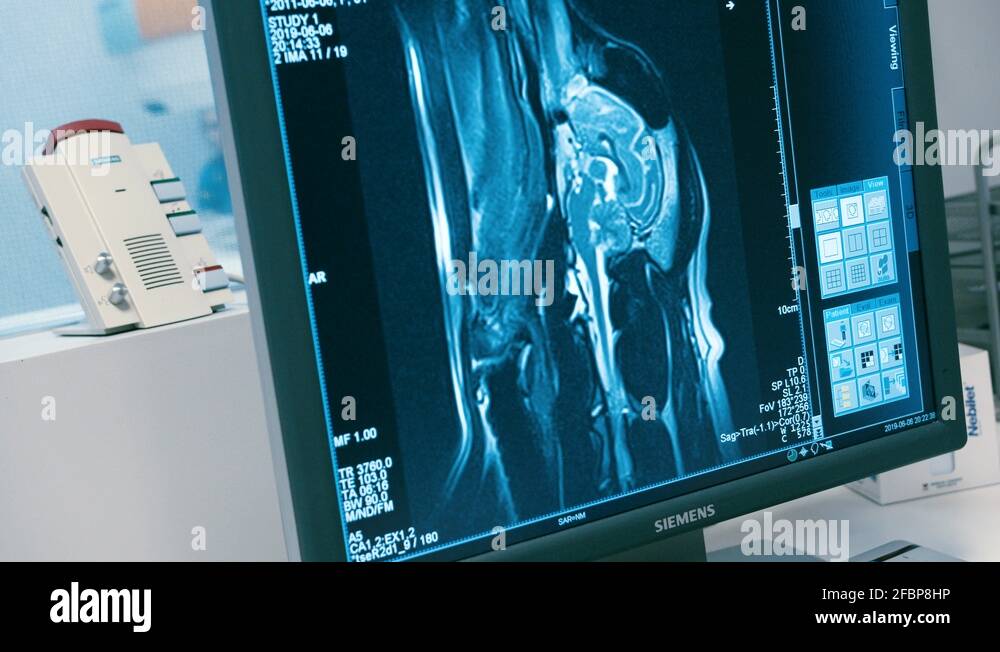 Scanner Control Panel With Monitor. Veterinarian checks a dog's X-Ray ...