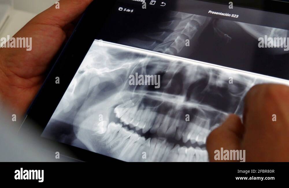 Radiography in use Stock Videos & Footage - HD and 4K Video Clips - Alamy