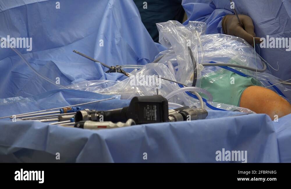 Anterior cruciate ligament reconstruction (ACL reconstruction) is a ...