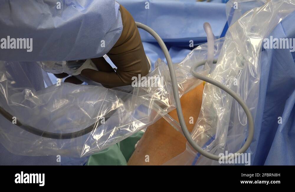 Anterior cruciate ligament reconstruction (ACL reconstruction) is a ...