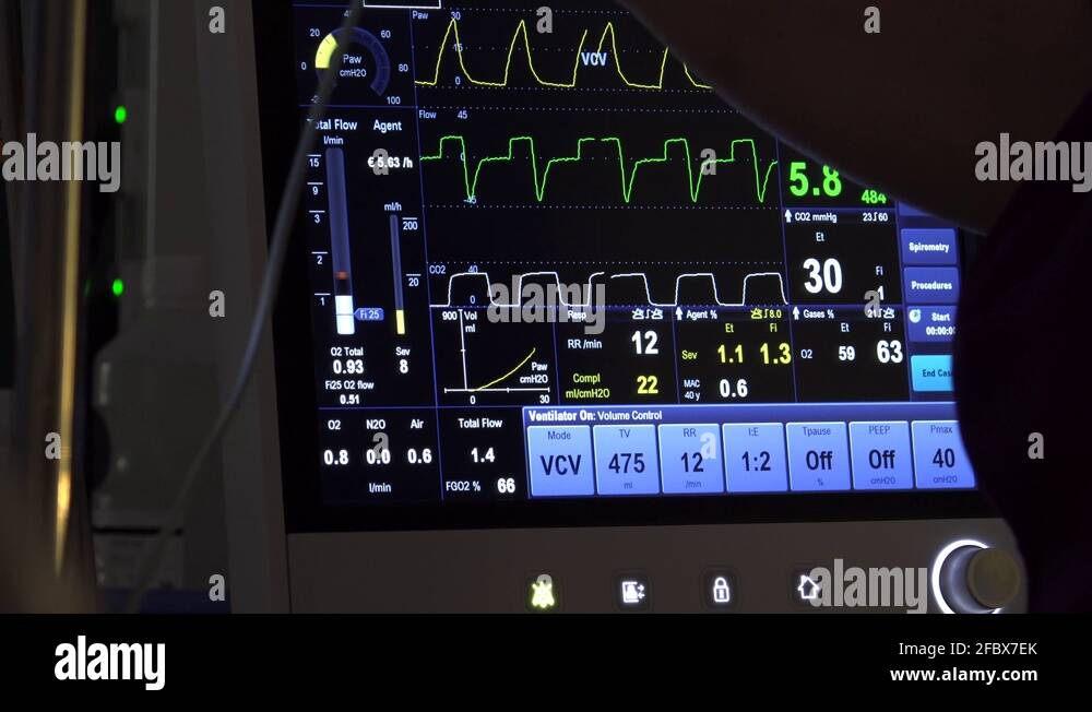 Heart disease monitoring Stock Videos & Footage - HD and 4K Video Clips ...