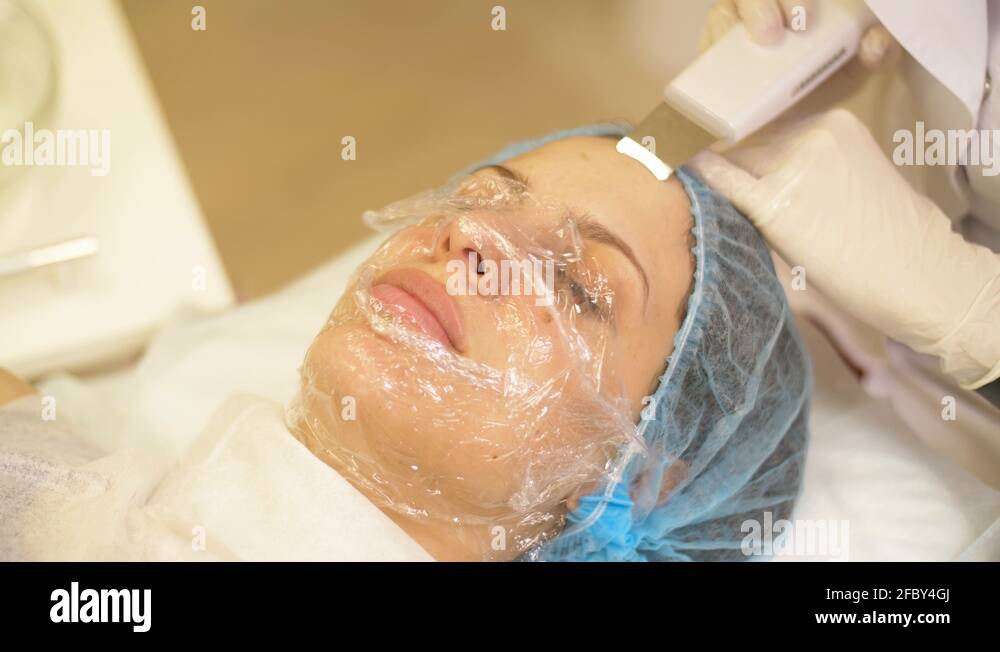 Laser removal of black dots from the skin of a young woman in a ...